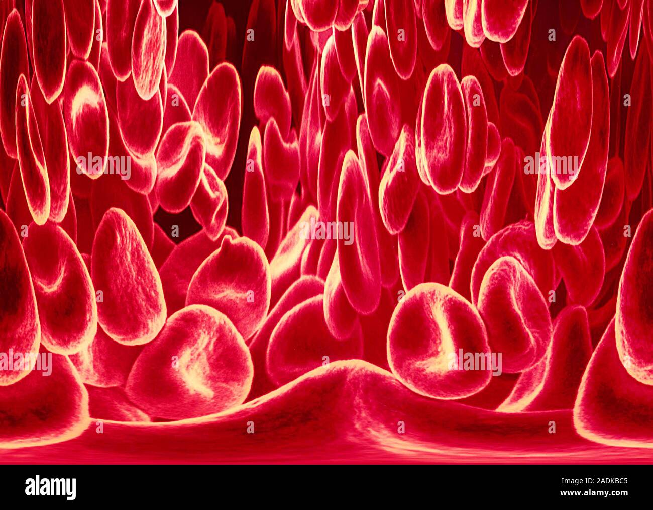 Red blood cells. Computer-enhanced scanning electron micrograph (SEM ...