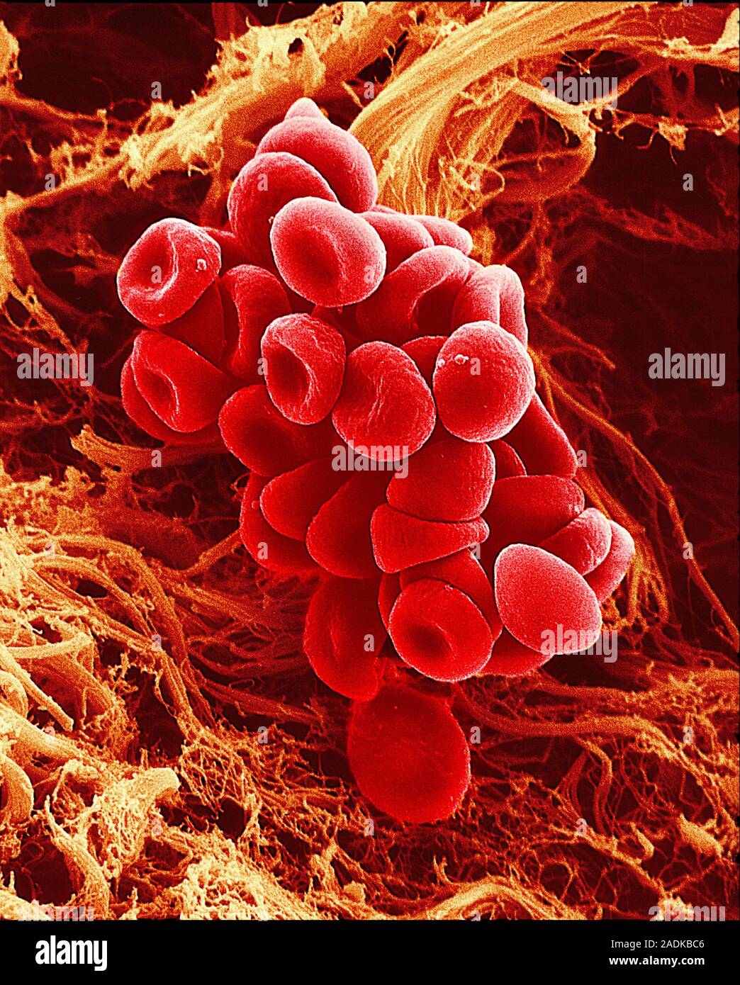 Red blood cells. Coloured scanning electron micrograph (SEM) of red ...