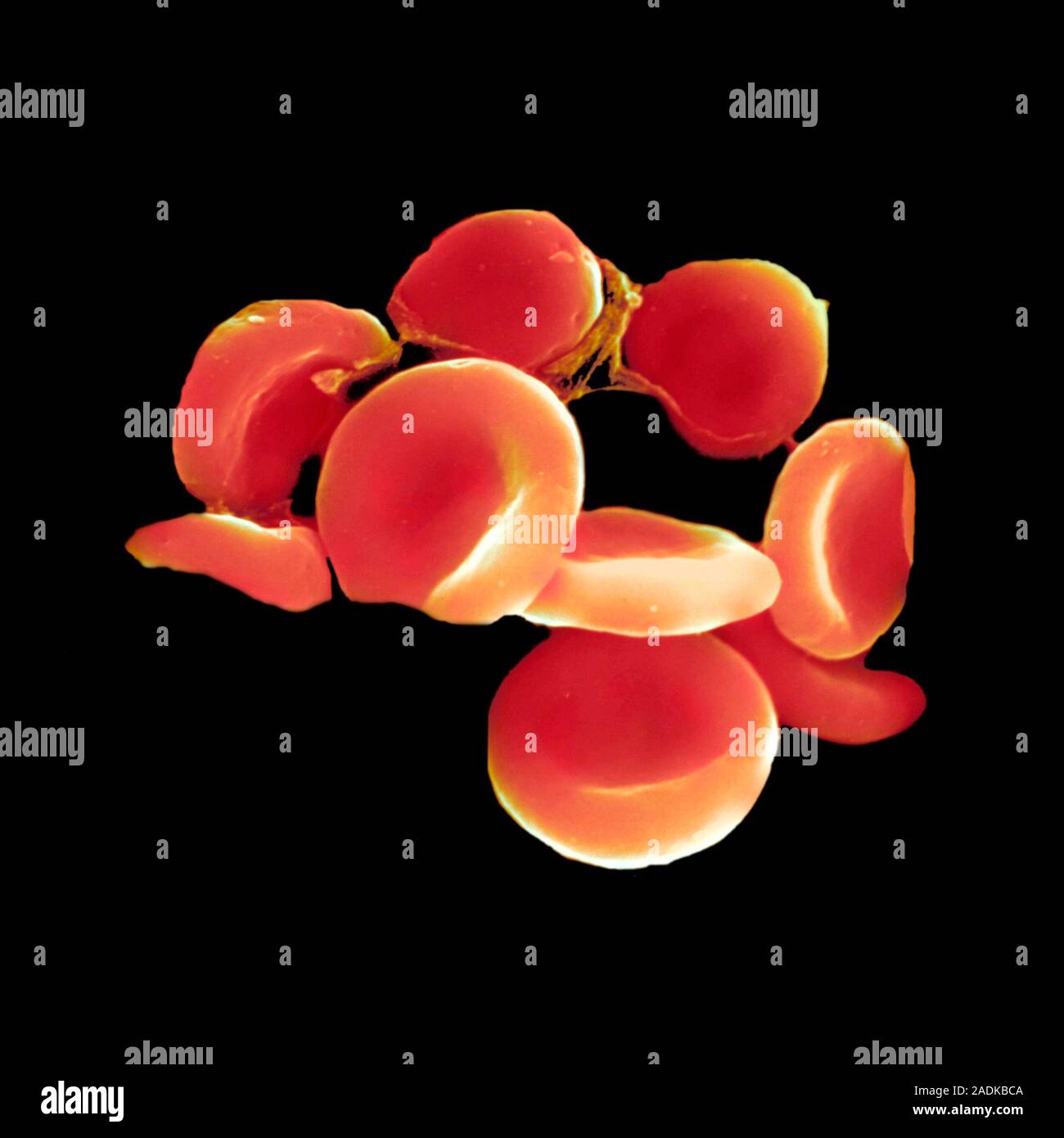 Red blood cells. Coloured scanning electron micrograph (SEM) of red ...