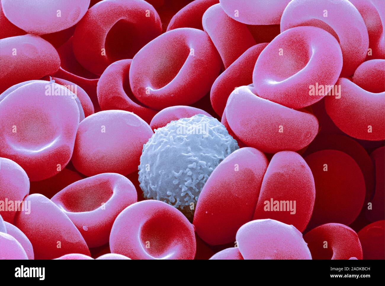 Blood cells. Coloured scanning electron micrograph (SEM) of red blood ...