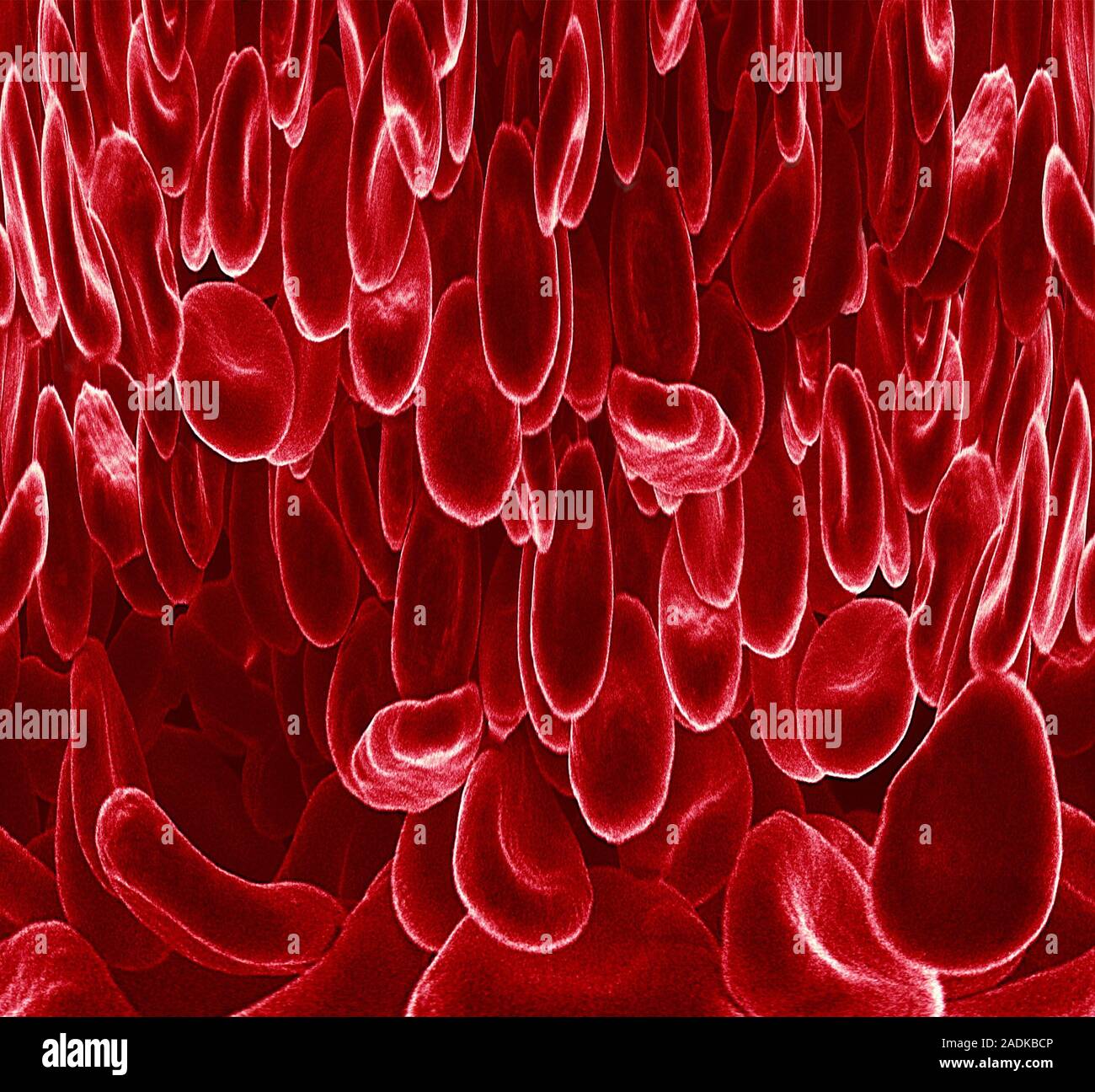 Red blood cells. Coloured scanning electron micrograph (SEM) of red ...