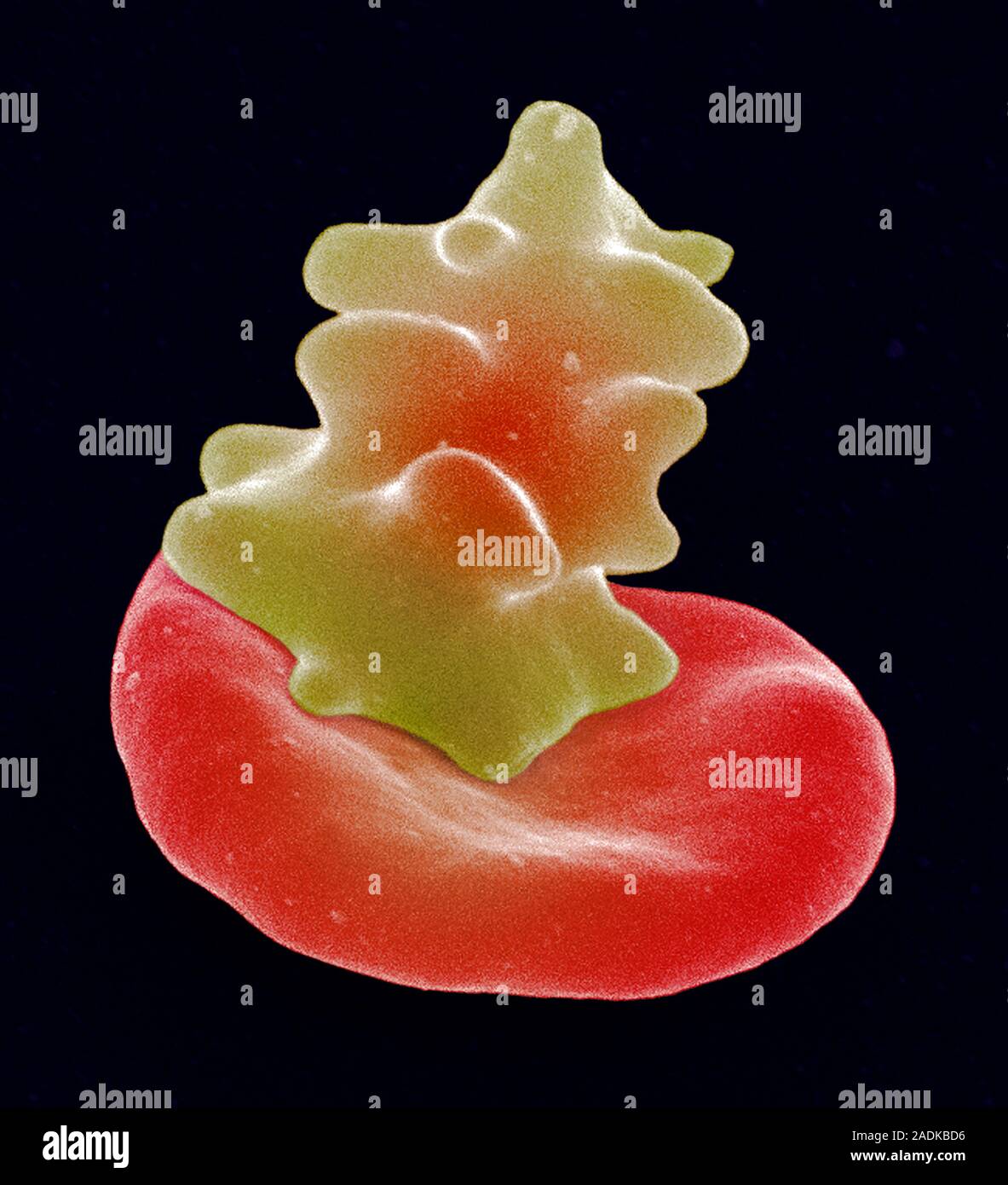 Red blood cell crenation. Coloured scanning electron micrograph (SEM ...