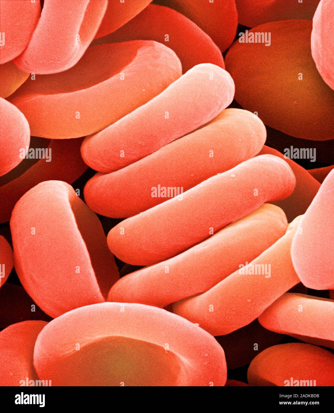 Red blood cells. Coloured scanning electron micrograph of red blood ...
