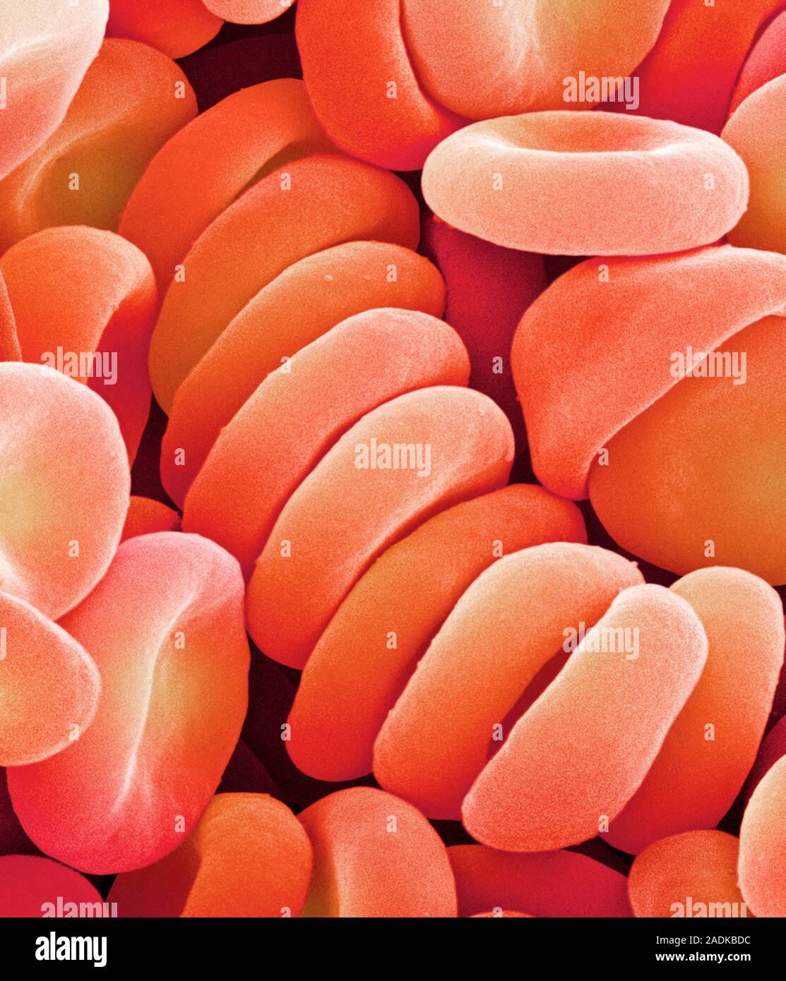 Red blood cells. Coloured scanning electron micro- graph of red blood ...