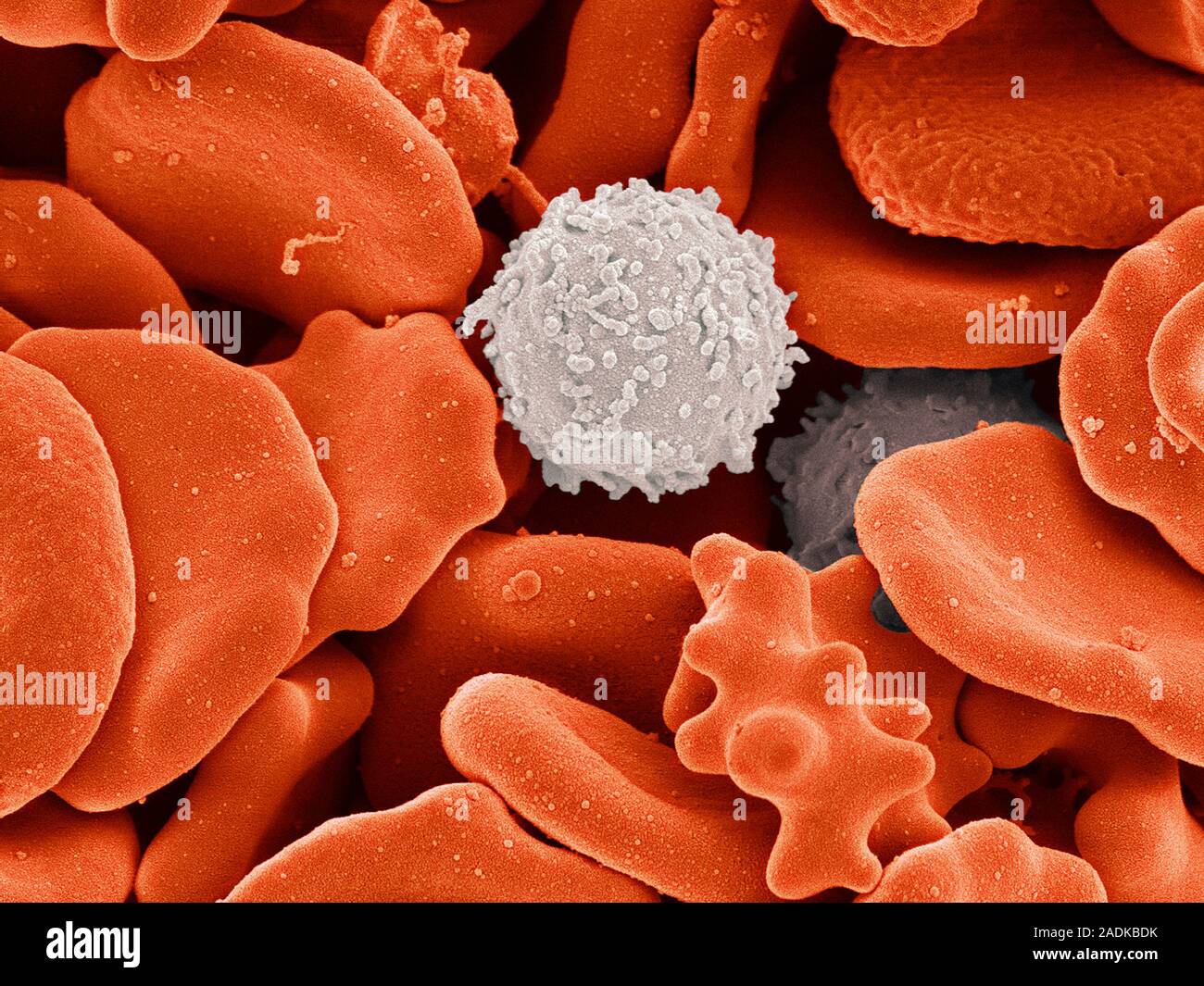 Blood cells. Coloured scanning electron micrograph (SEM) of red blood ...