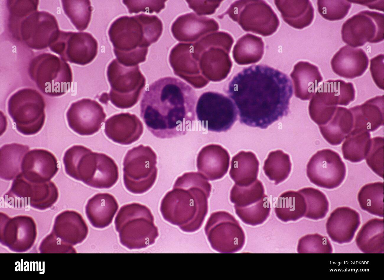 Blood cells. Light micrograph of red blood cells and three white blood ...