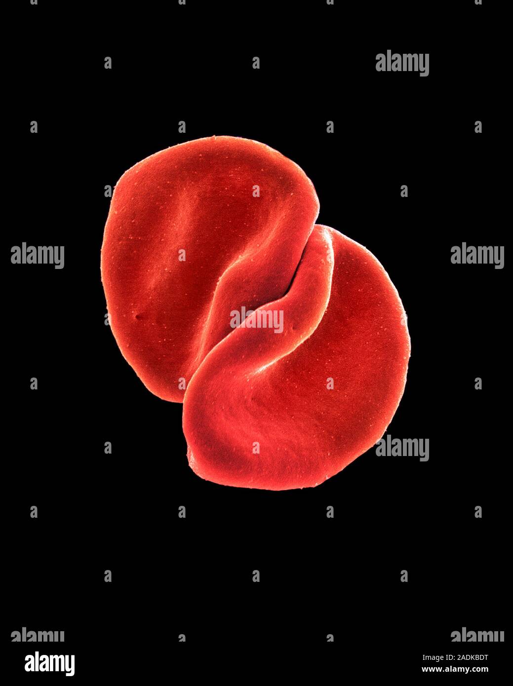 Red blood cells. Coloured scanning electron micrograph (SEM) of two red ...