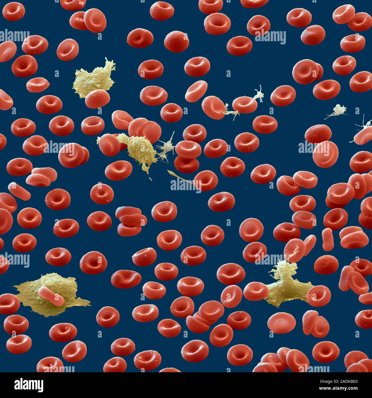 Blood cells. Coloured scanning electron micrograph (SEM) of red blood ...