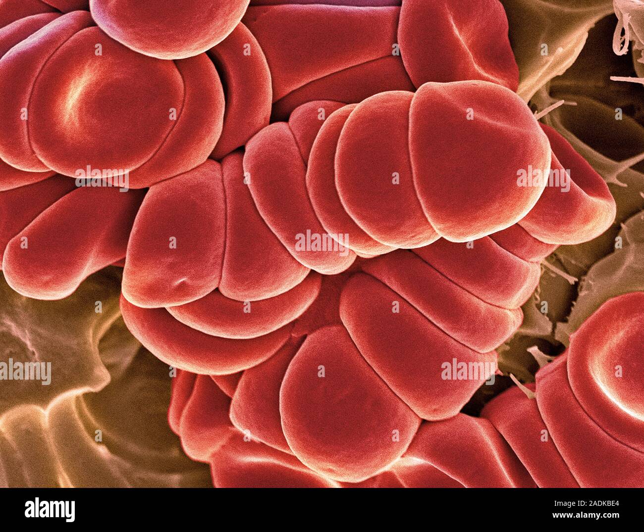 Red blood cells. Coloured scanning electron micrograph of red blood ...