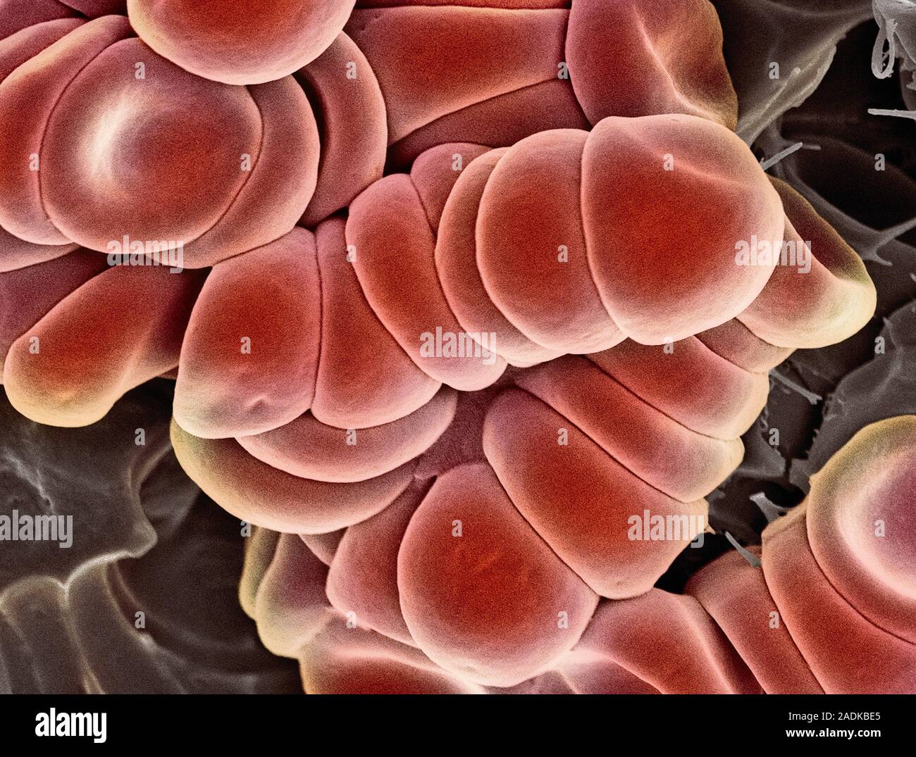 Red blood cells. Coloured scanning electron micro- graph of red blood ...