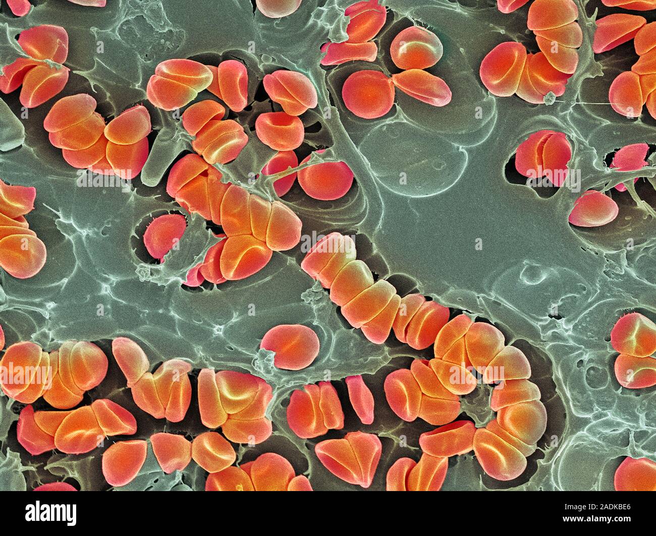 Red blood cells. Coloured scanning electron micrograph of red blood ...