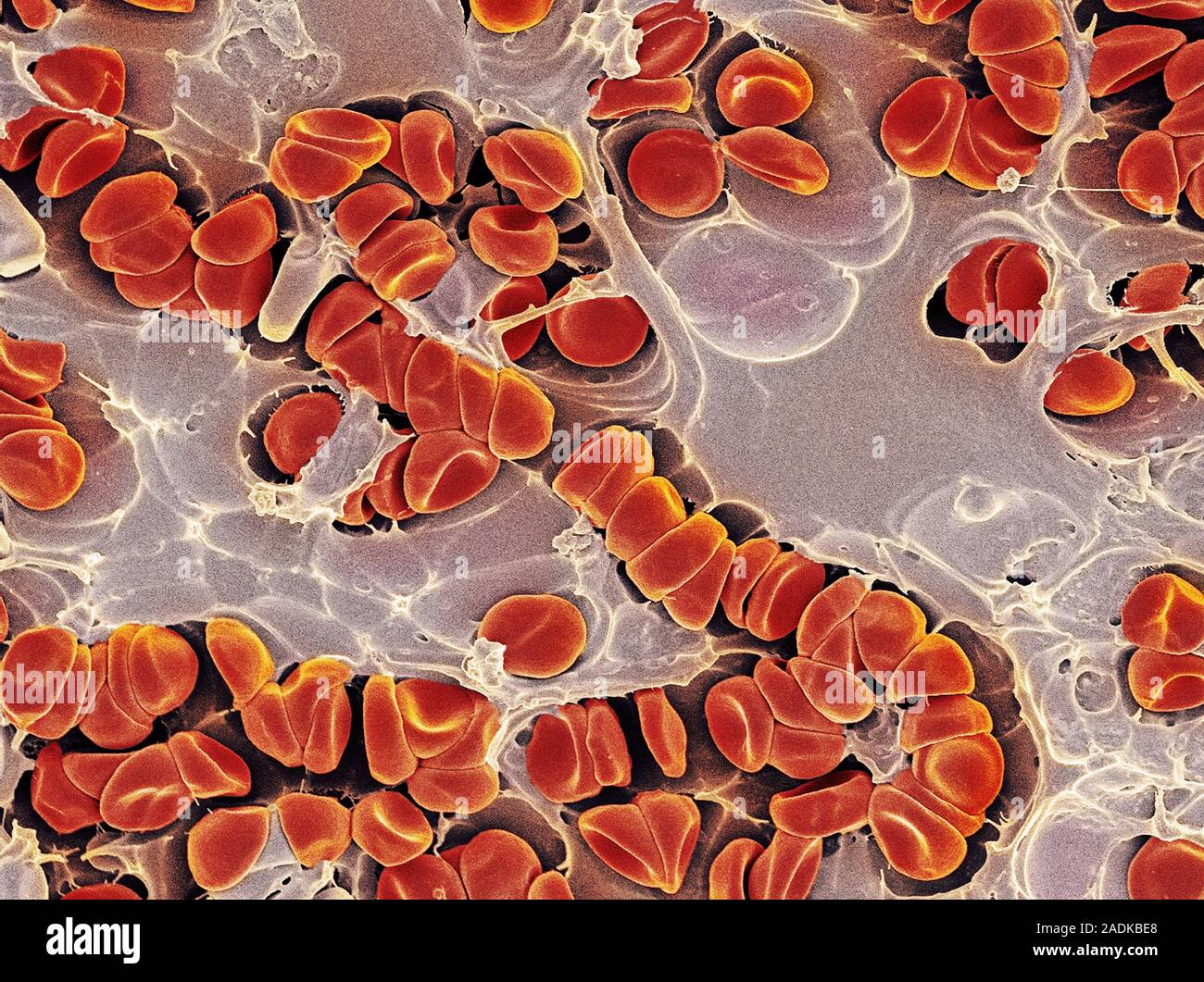 Red blood cells. Coloured scanning electron micrograph of red blood ...