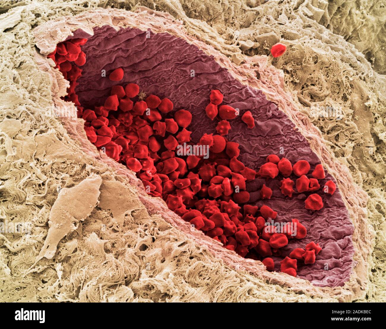 Red blood cells. Coloured scanning electron micrograph (SEM) of human ...