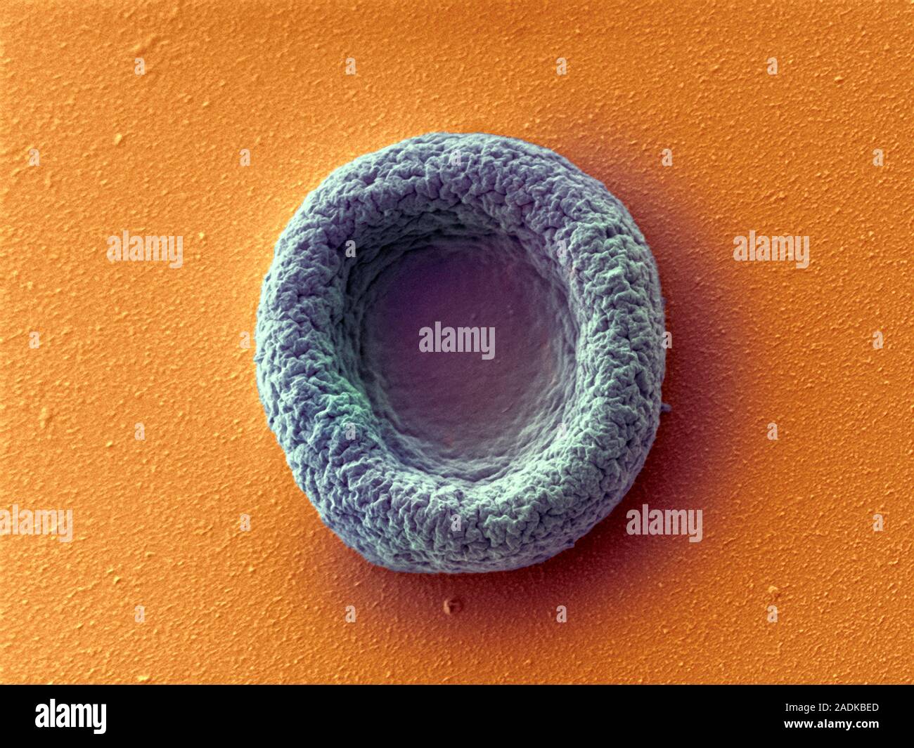Red blood cell. Coloured scanning electron micrograph (SEM) of a human ...