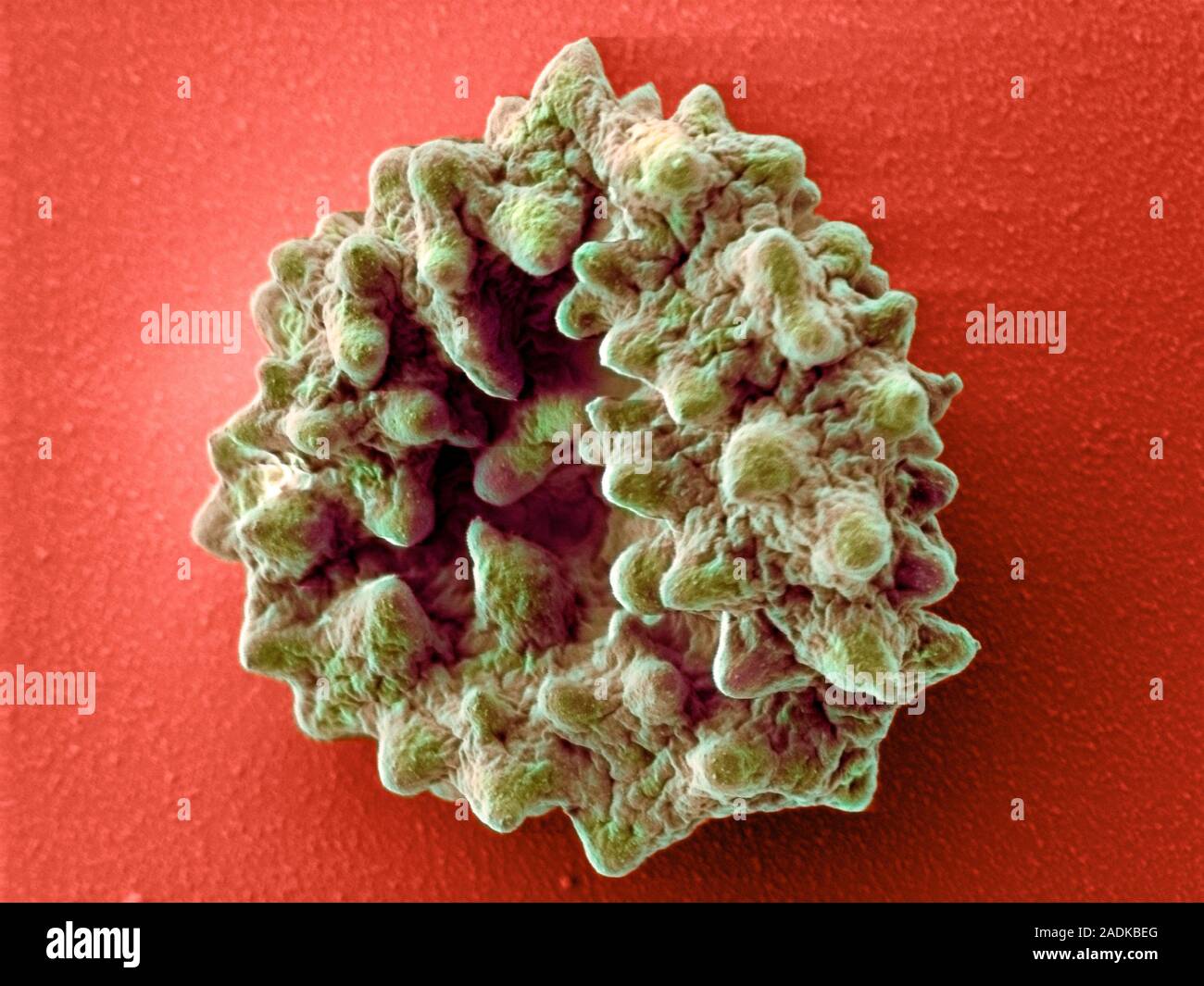 Crenated red blood cell. Coloured scanning electron micrograph (SEM) of ...
