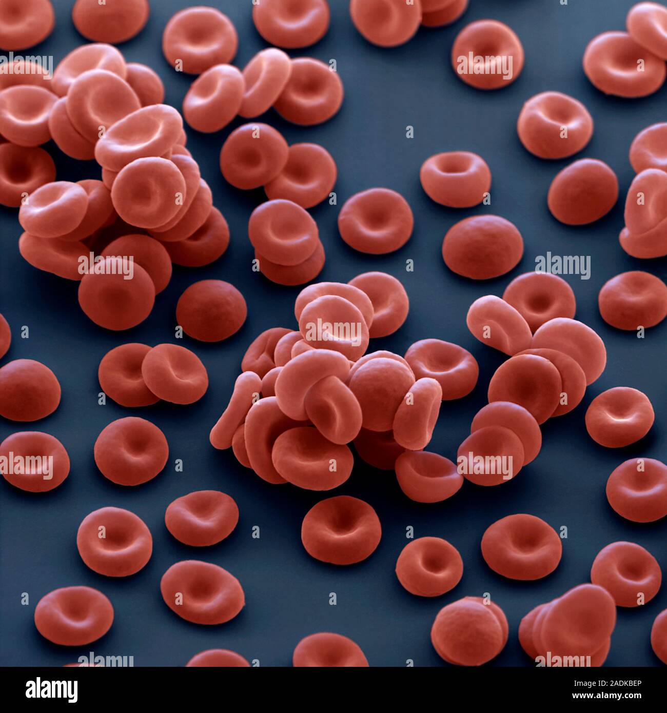 Biconcave Disc RED BLOOD CELLS ARE BICONCAVE