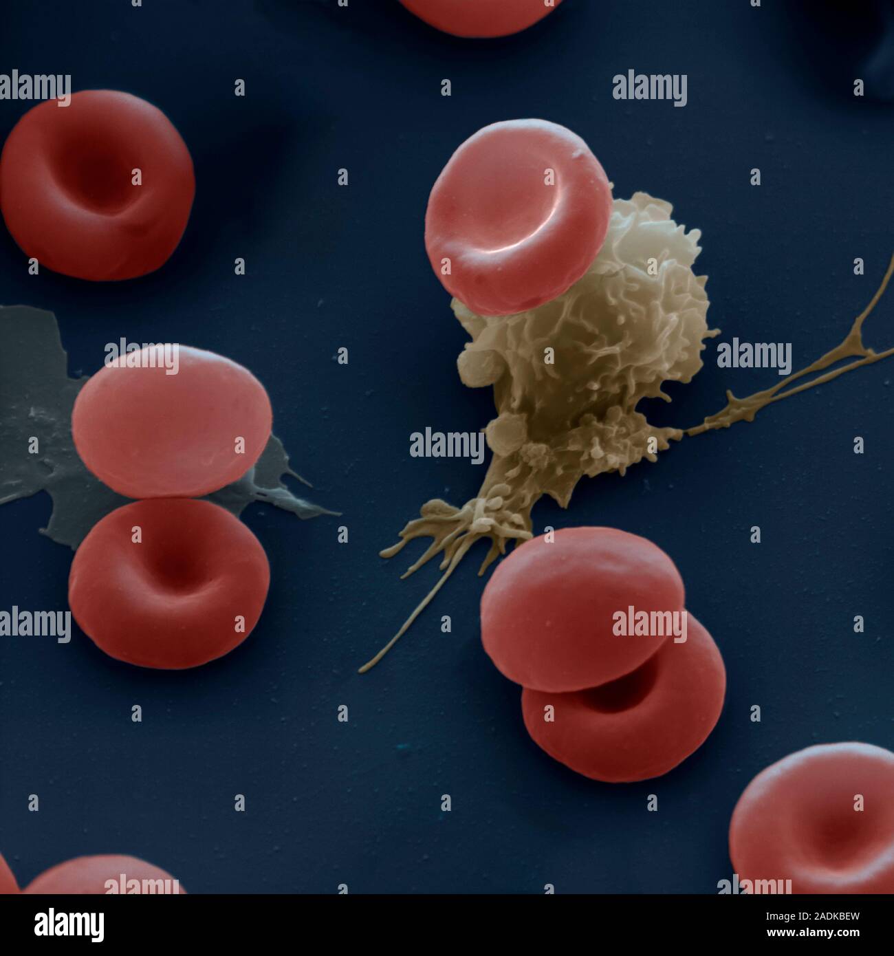 Blood cells. Coloured scanning electron micrograph (SEM) of red blood ...