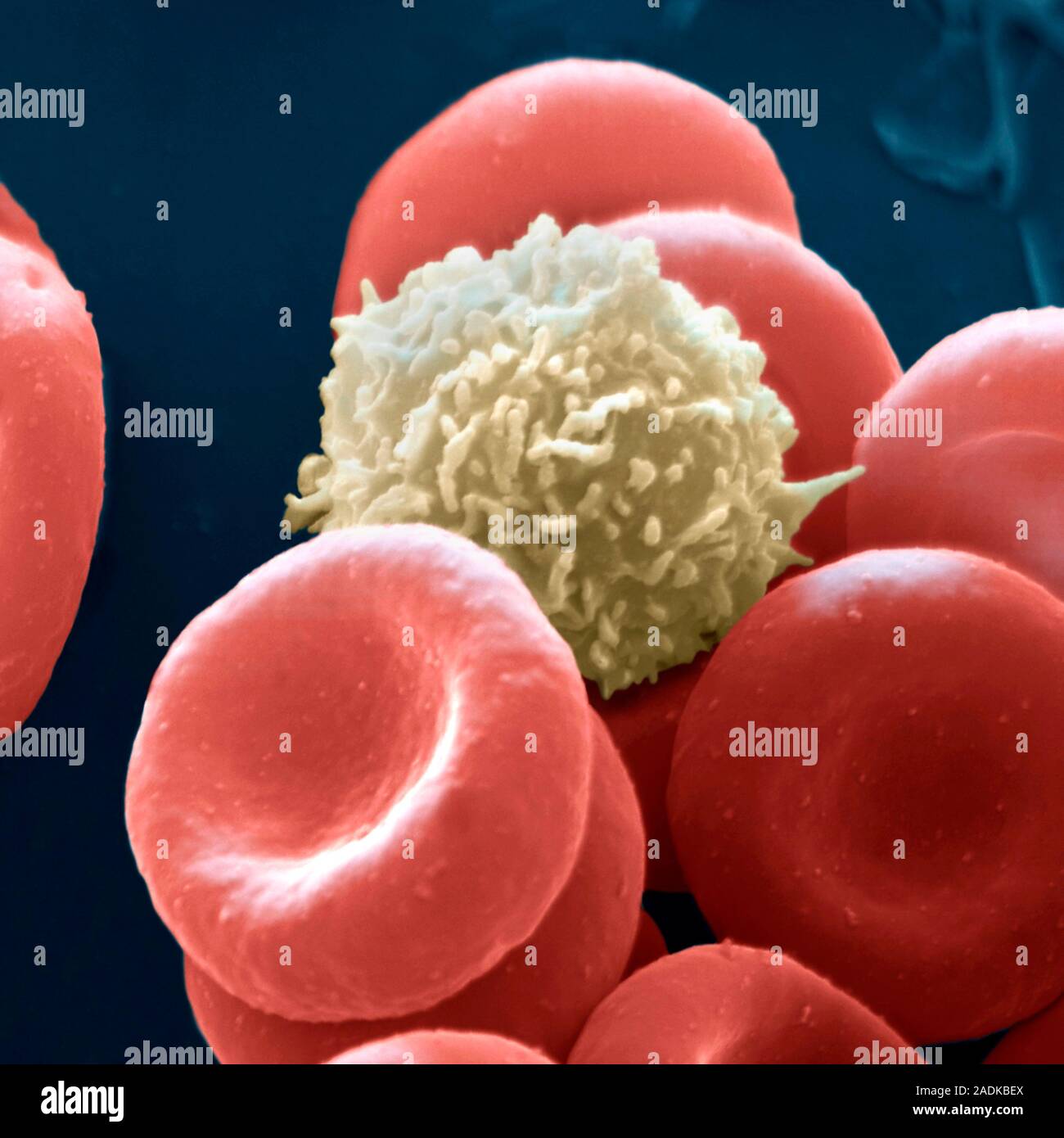 Blood cells. Coloured scanning electron micrograph (SEM) of human red ...
