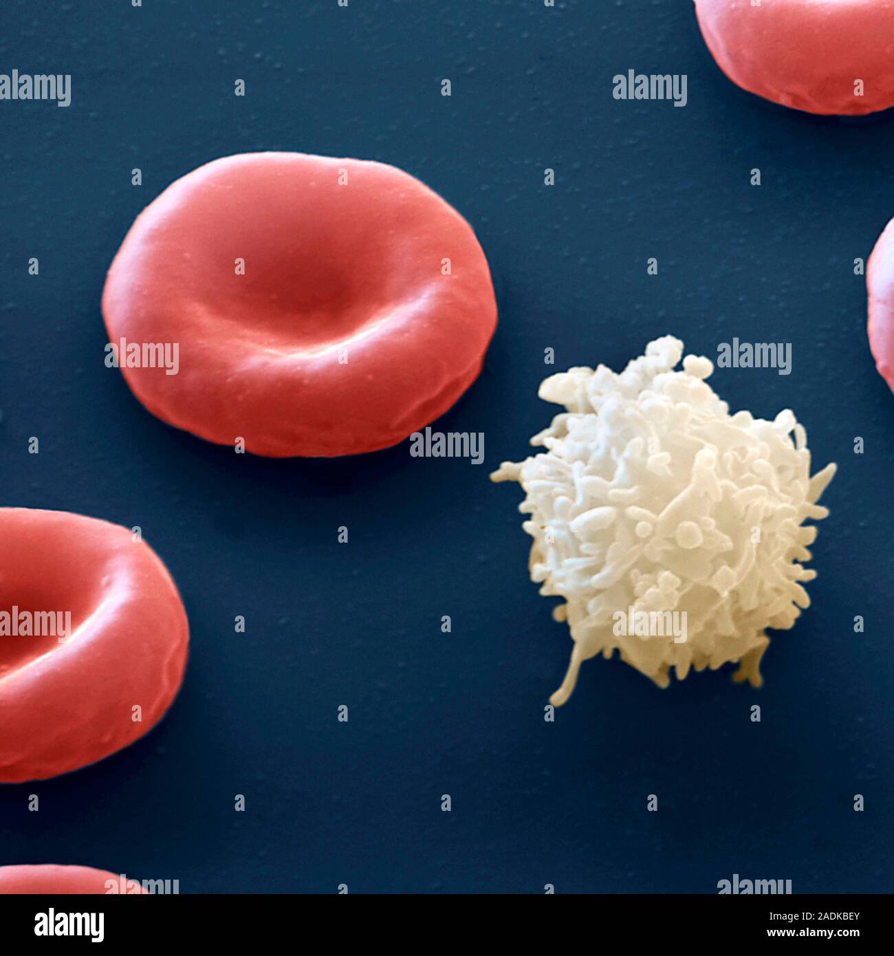 Blood cells. Coloured scanning electron micrograph (SEM) of human red ...