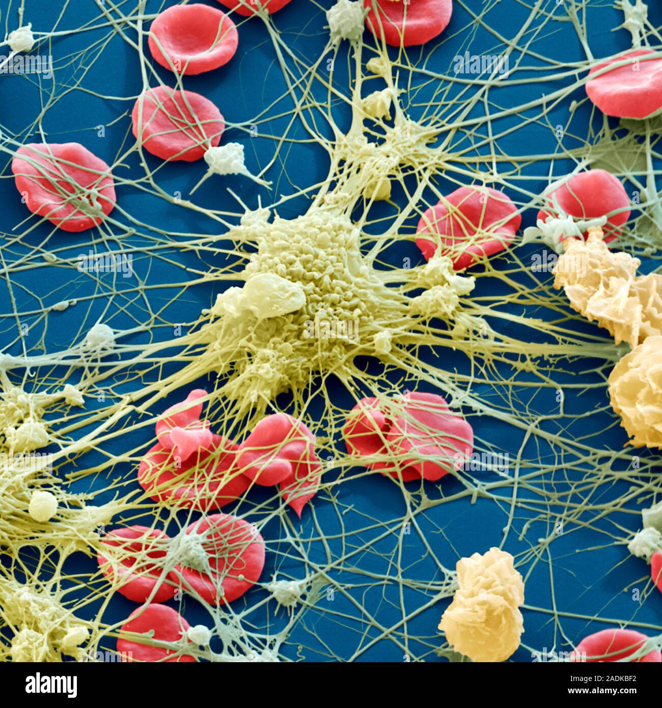 Blood cells. Coloured scanning electron micrograph (SEM) of human red ...