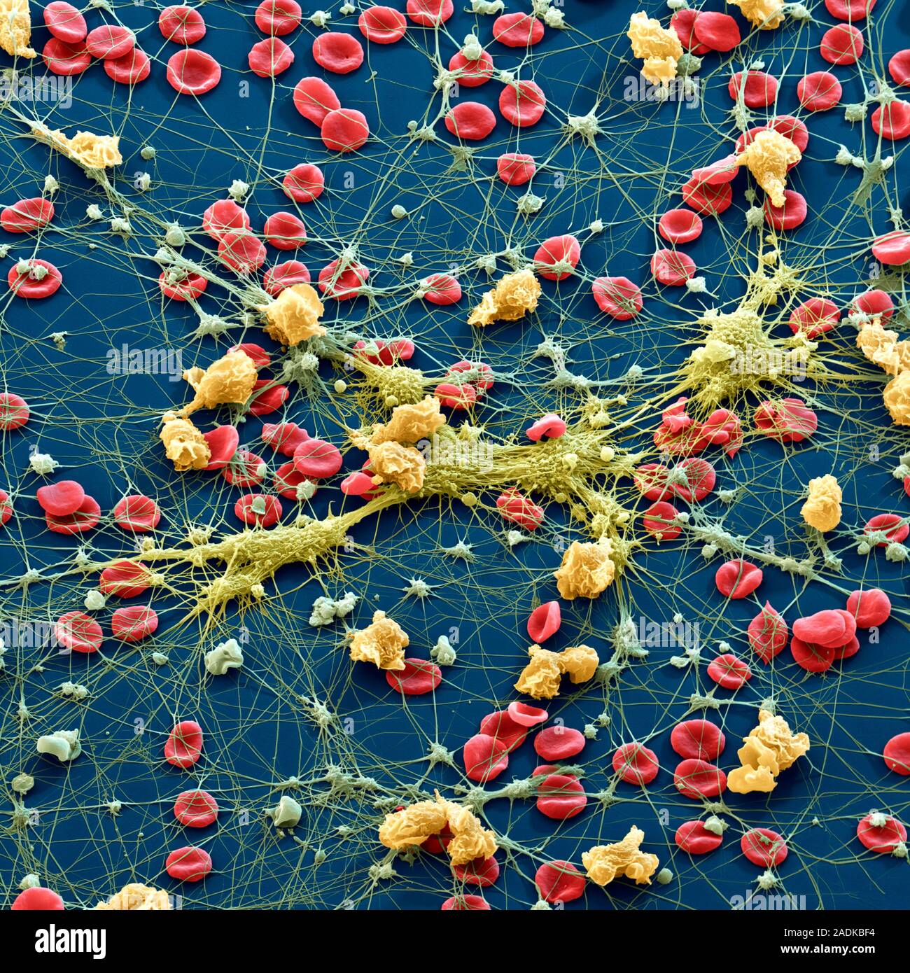 Blood cells. Coloured scanning electron micrograph (SEM) of human red ...