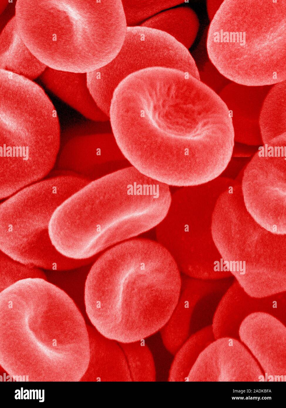 Red blood cells. Coloured scanning electron micrograph (SEM) of red ...