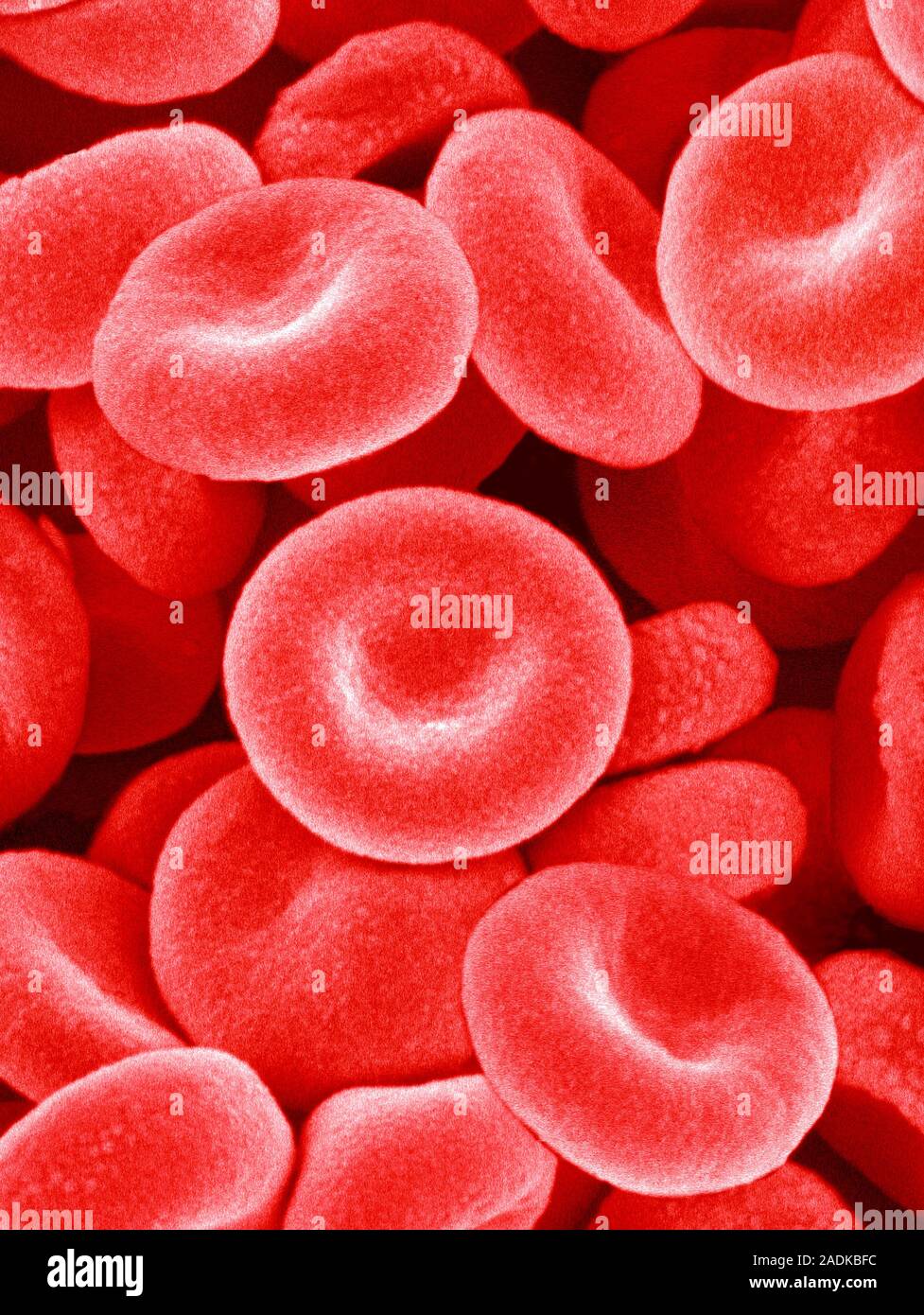 Red blood cells. Coloured scanning electron micrograph (SEM) of red ...