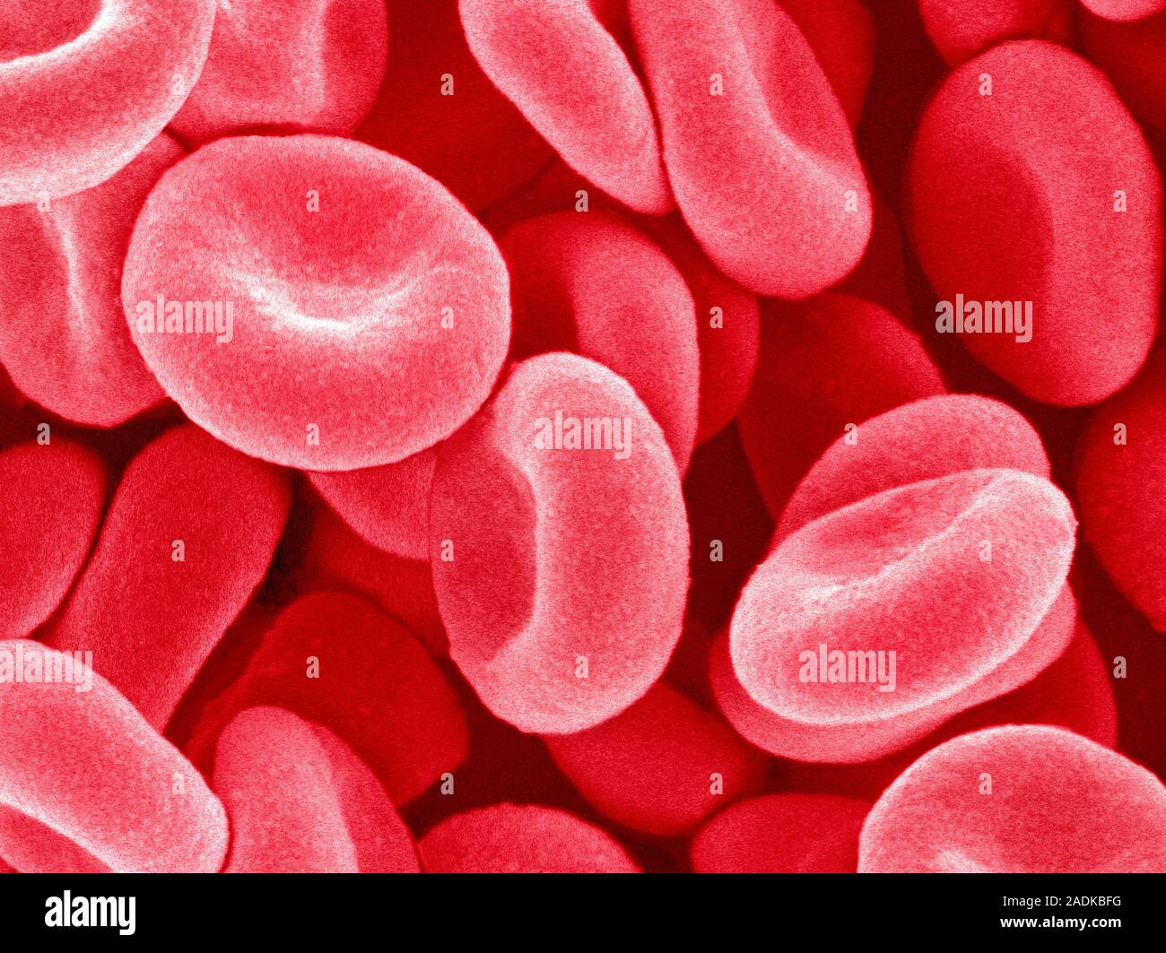 Red blood cells. Coloured scanning electron micrograph (SEM) of red ...