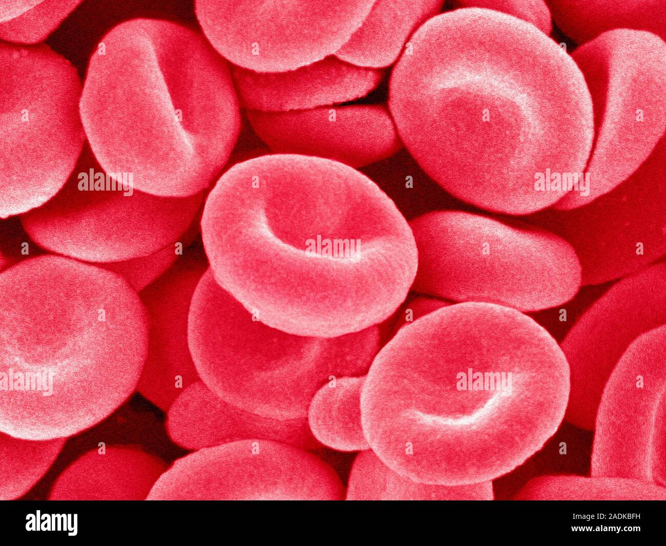 Red blood cells. Coloured scanning electron micrograph (SEM) of red ...