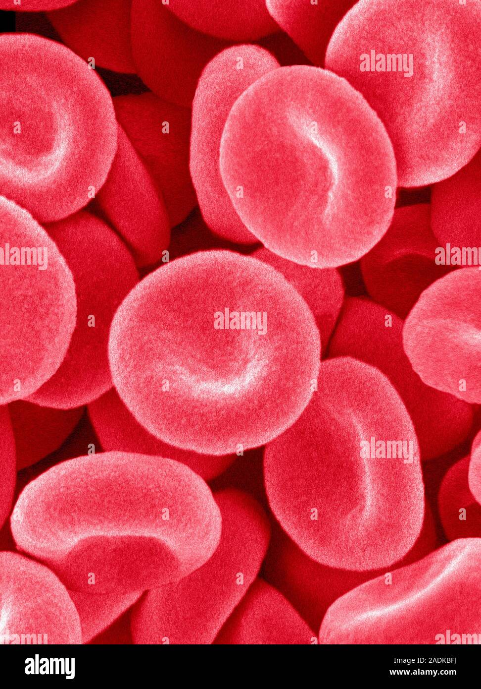 Red blood cells. Coloured scanning electron micrograph (SEM) of red ...