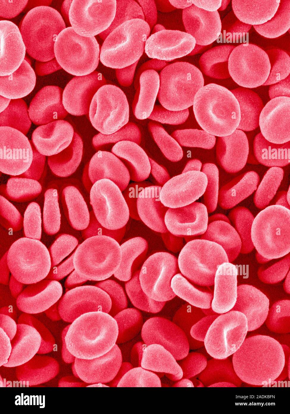 Red blood cells. Coloured scanning electron micrograph (SEM) of red ...