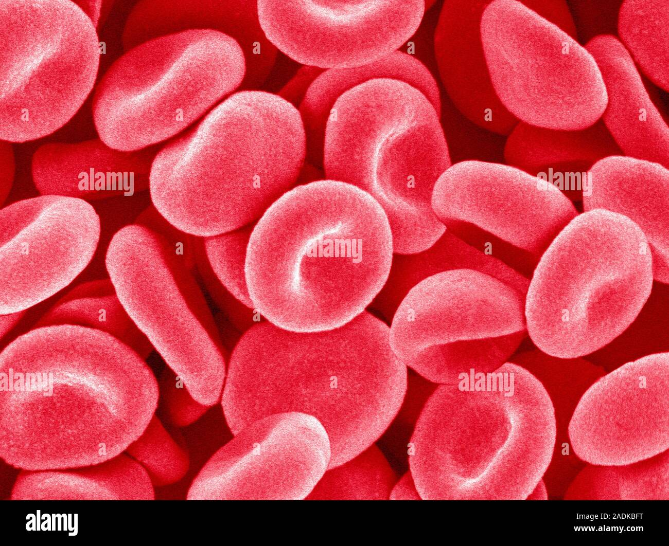 Red blood cells. Coloured scanning electron micrograph (SEM) of red ...