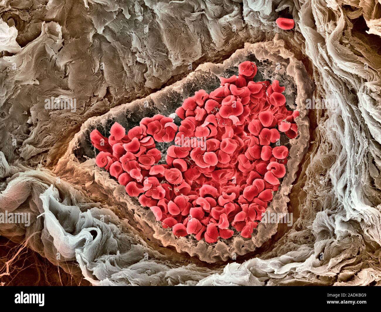 Red blood cells. Coloured scanning electron micrograph (SEM) of human ...
