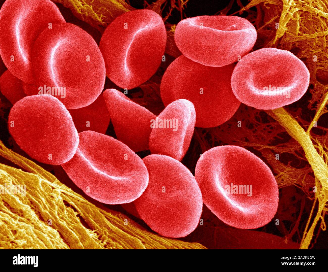 Red blood cells. Coloured scanning electron micrograph (SEM) of human ...