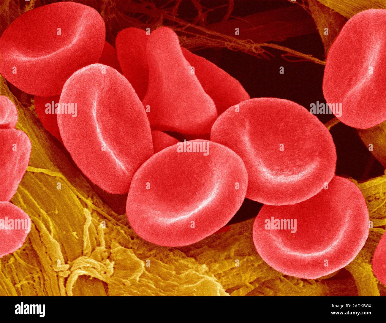 Red blood cells. Coloured scanning electron micrograph (SEM) of human ...