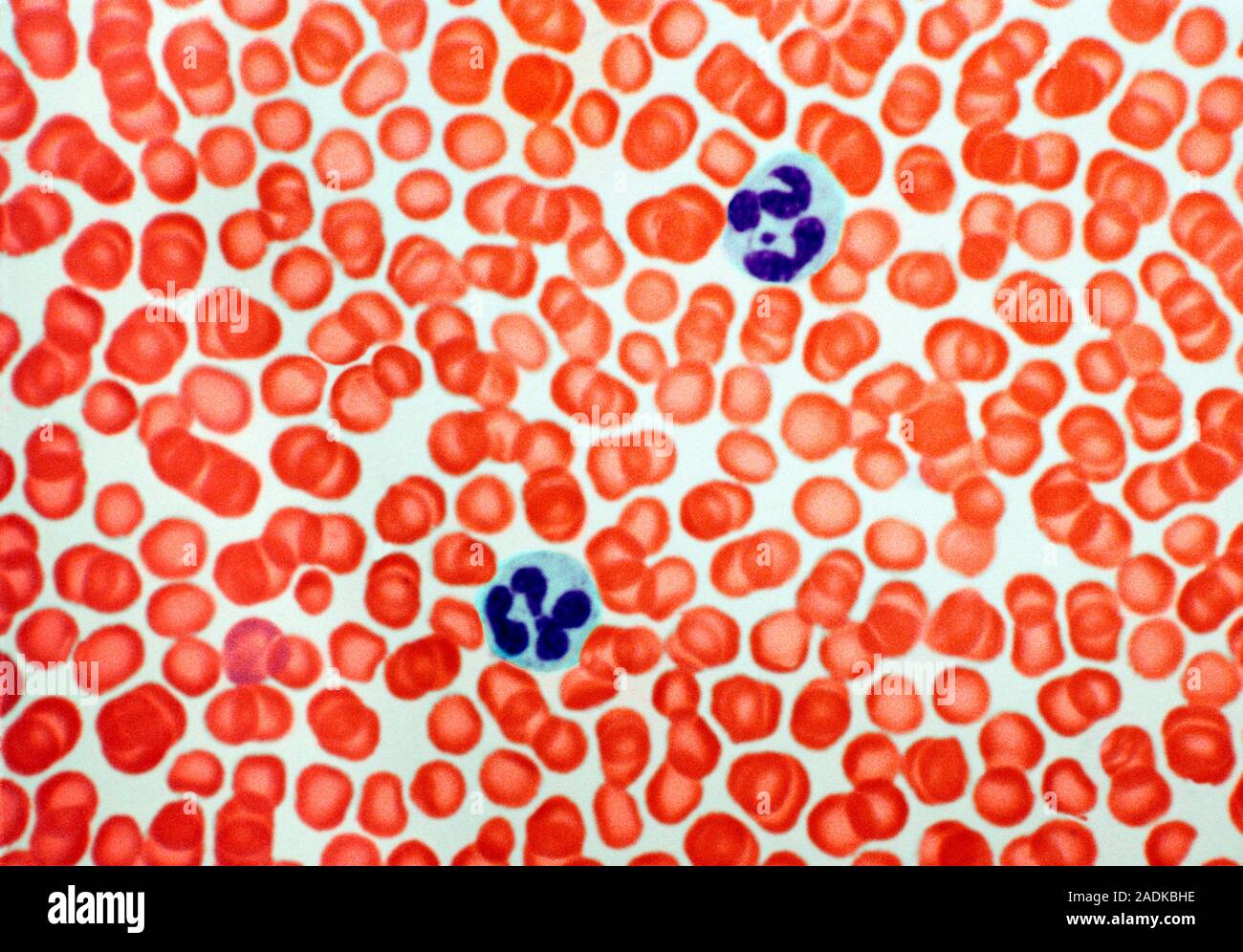 Human blood cells. Light micrograph of erythrocytes (red) surrounding ...