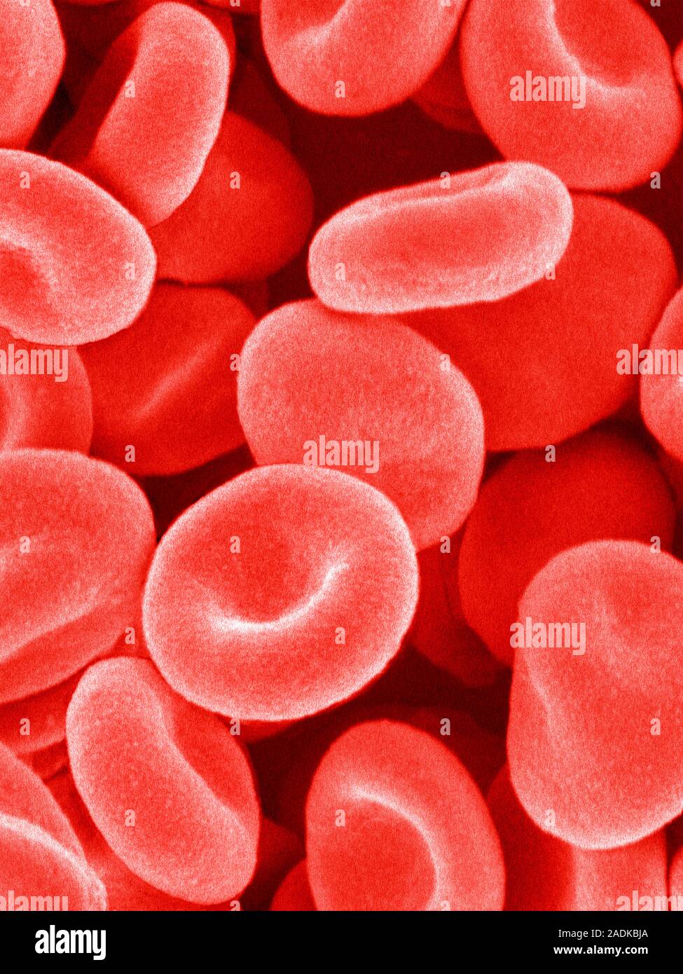 Red blood cells, coloured scanning electron micrograph (SEM). Red blood ...