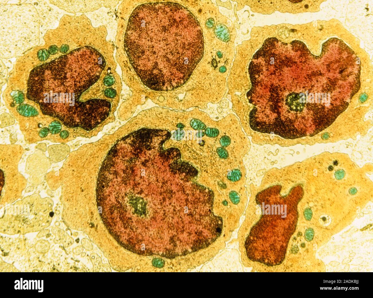 False-colour transmission electron micrograph (TEM) of a group of human ...