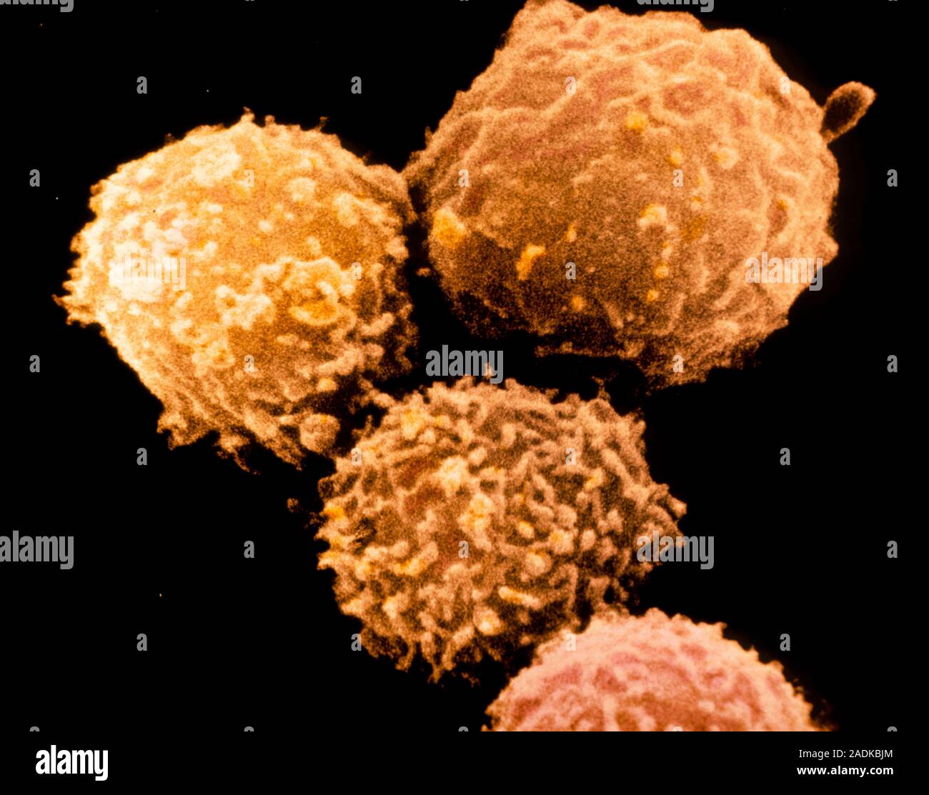 Scanning electron micrograph (SEM) of human B-lymphocytes. They are ...