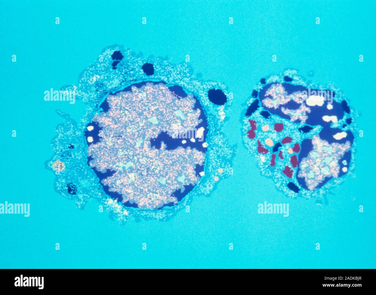 False-colour transmission electron micrograph (TEM) of a single ...
