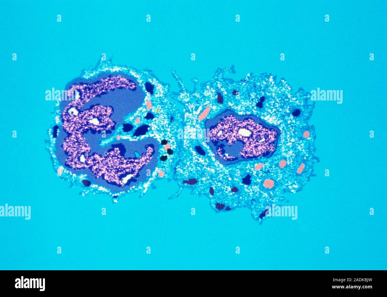 False-colour transmission electron micrograph (TEM) of a single ...