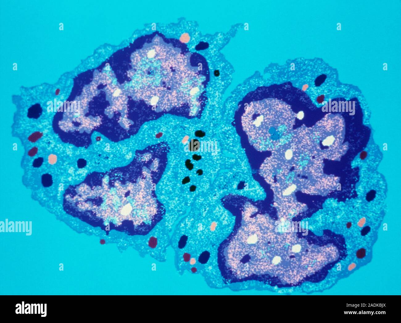 False-colour transmission electron micrograph (TEM) of a single ...