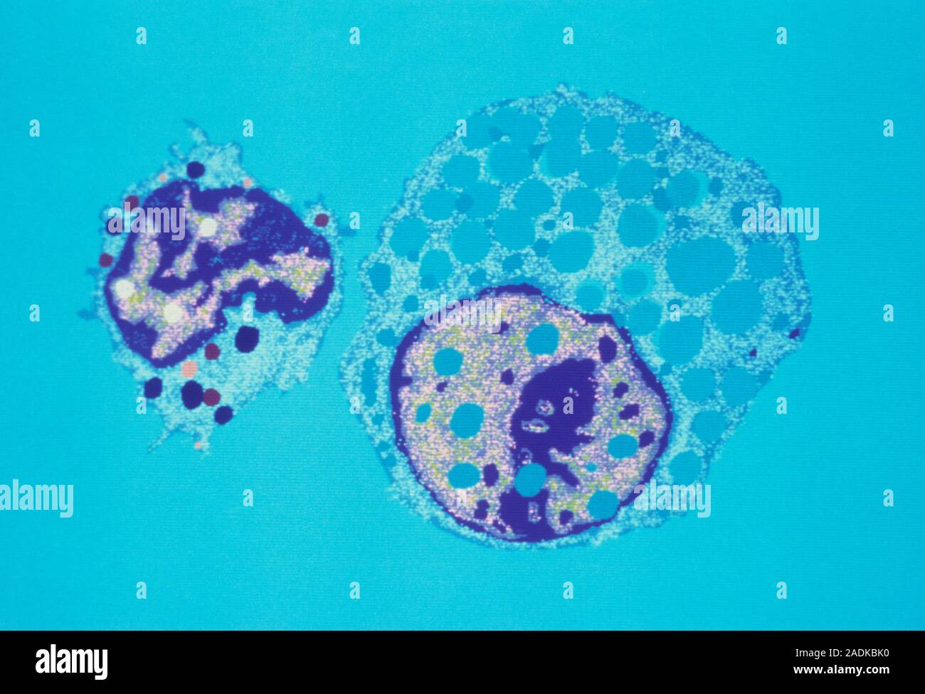False-colour transmission electron micrograph (TEM) of a single ...