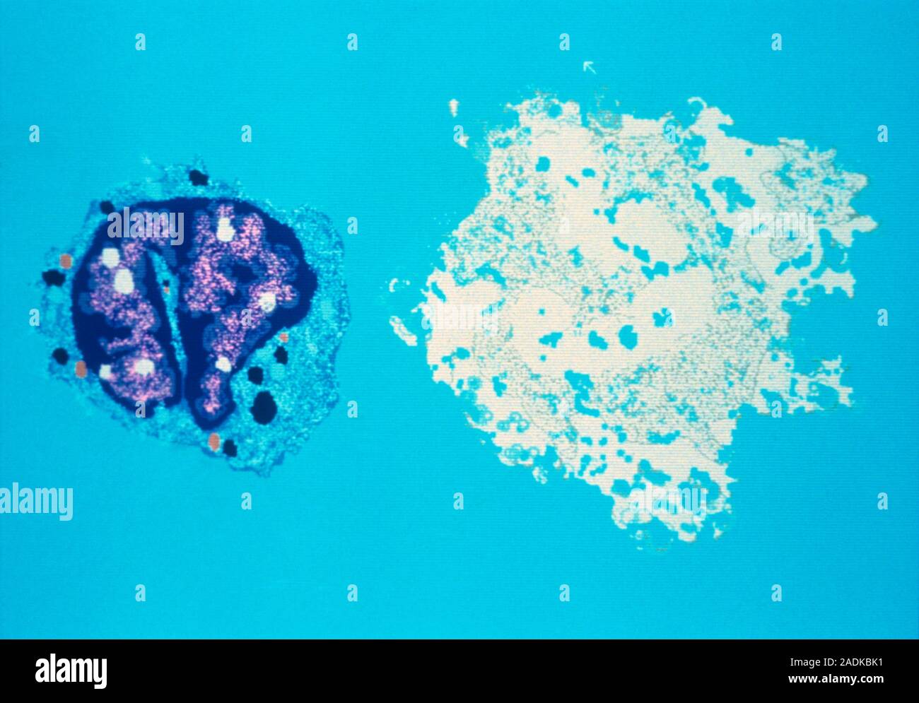 False-colour transmission electron micrograph (TEM) of a single ...