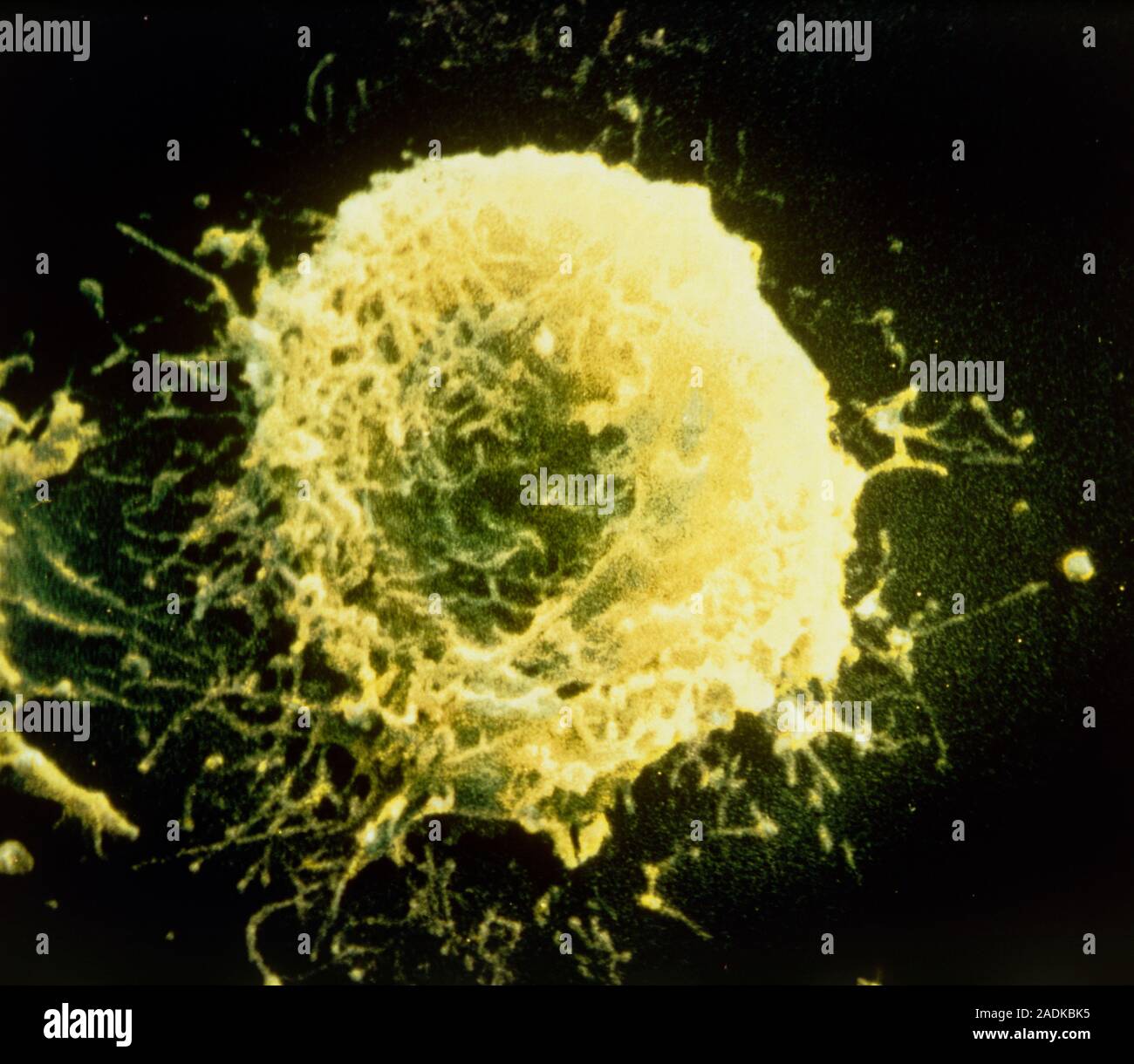 False colour scanning electron micrograph (SEM) of a granulocyte (also ...
