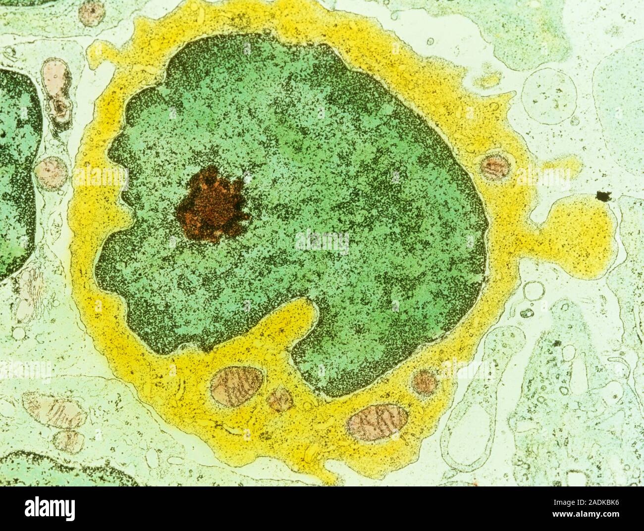 False-colour transmission electron micrograph (TEM) of a single human ...