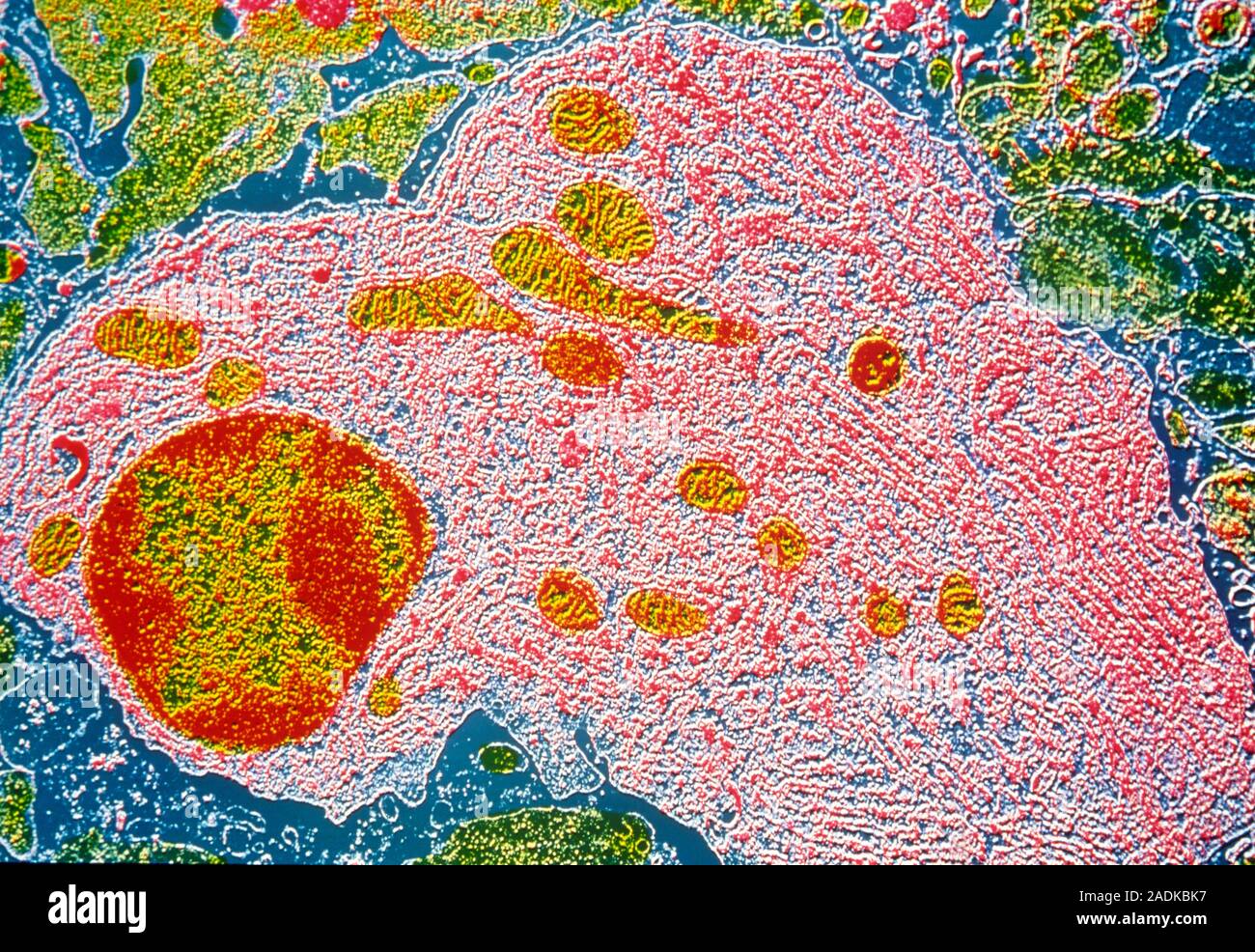 False-colour transmission electron micrograph (TEM) of a human ...