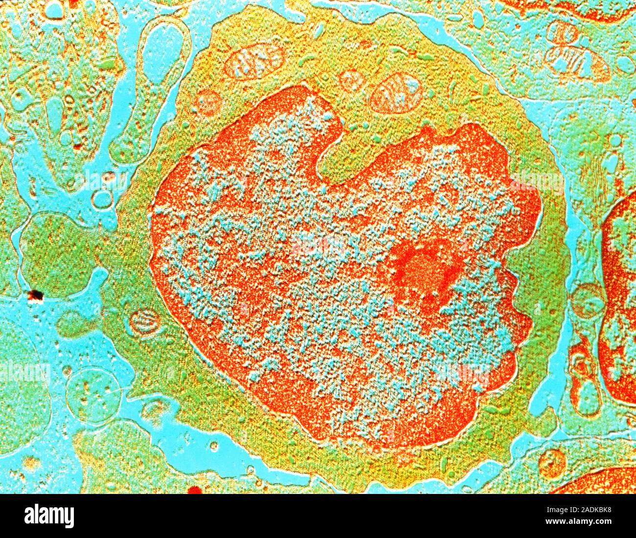 False-colour transmission electron micrograph (TEM) of a single human ...