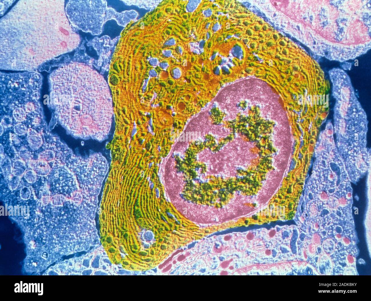 False-colour transmission electron micrograph (TEM) of a human ...