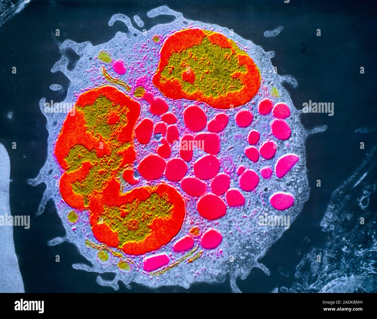 False-colour transmission electron micrograph (TEM) of a single ...